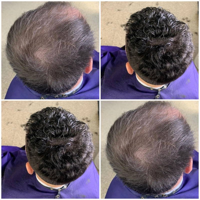 Dallas Man Weave | Get Hair Unit Installation in Dallas Tx