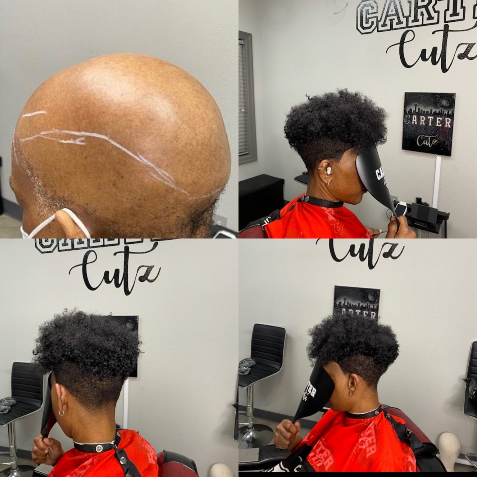 Ace Man Weave Units | Hair Weave For Men With Hair Loss