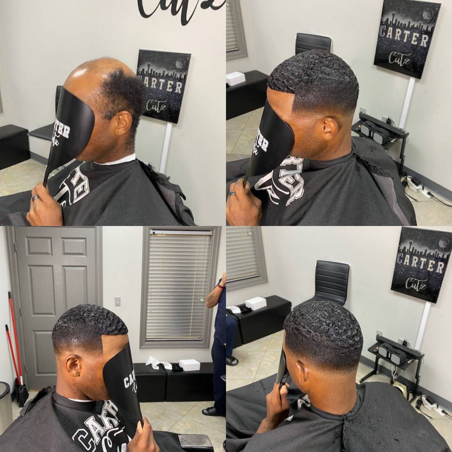 Ace Man Weave Units | Hair Weave For Men With Hair Loss