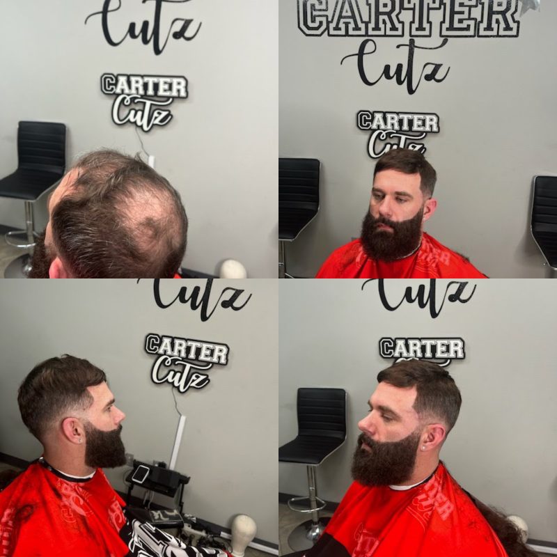 Ace Man Weave Units | Hair Weave For Men With Hair Loss